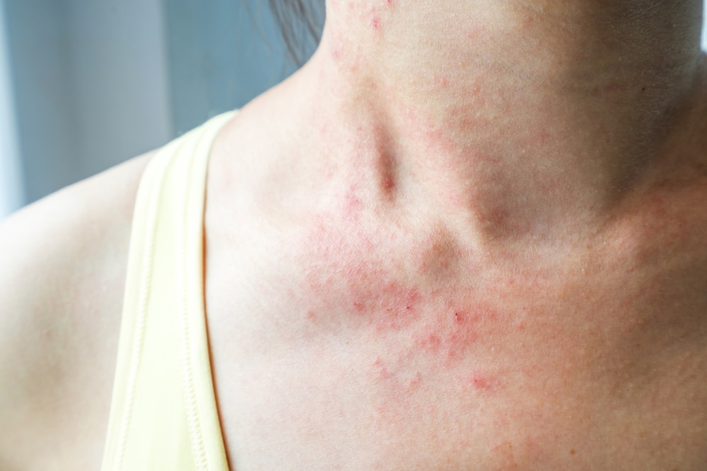 How Does Leukemia Affect the Body? | Health and Wellness