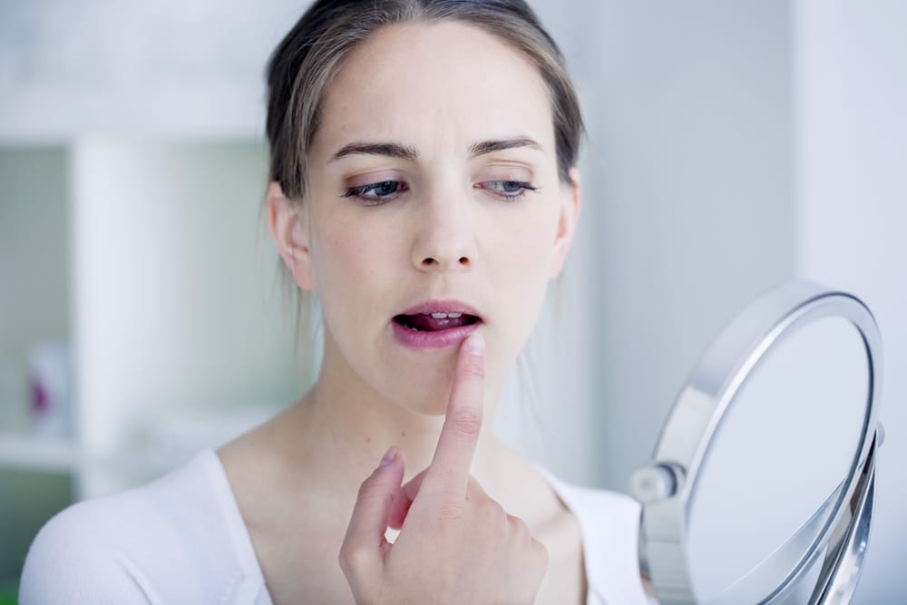 What Causes Chapped Lips And How To Prevent Them Health And Wellness