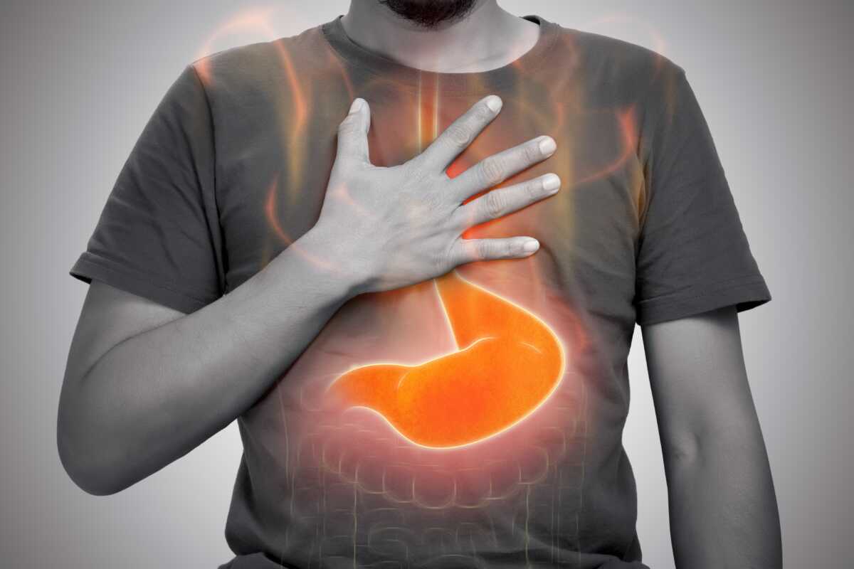 Feeling the Burn: Can Your Stress Levels Ignite Acid Reflux? | Health ...