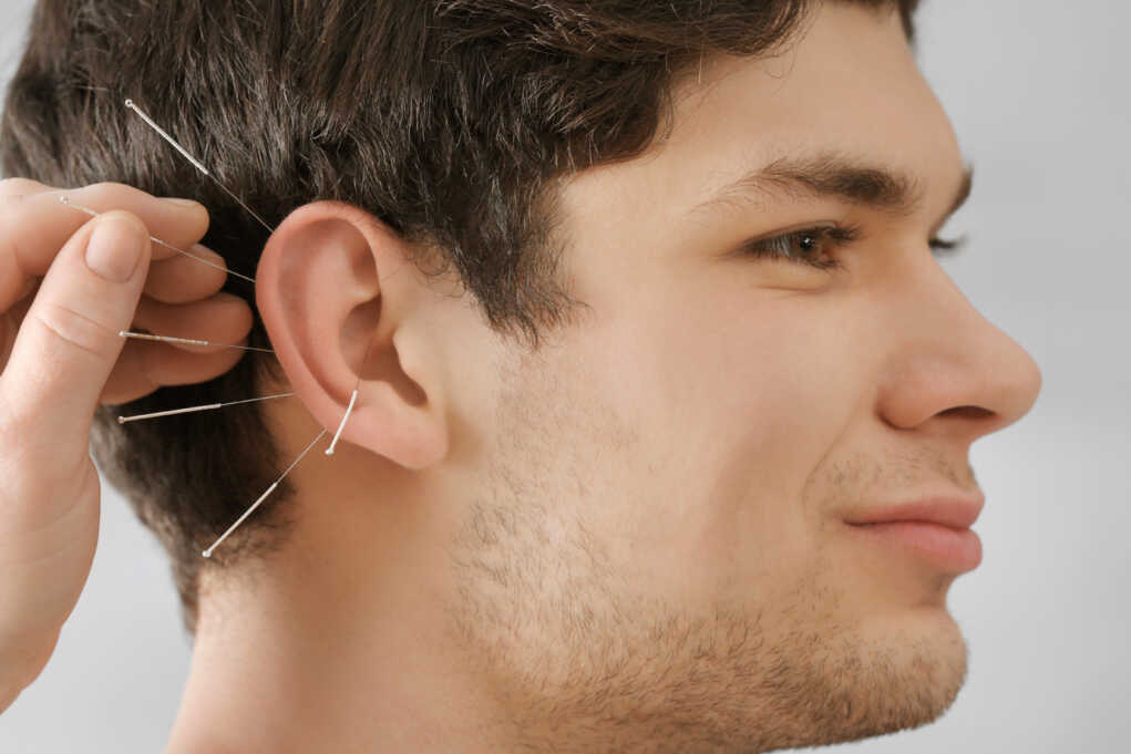 The Benefits of Ear Acupuncture: What It’s Good For | Health and Wellness